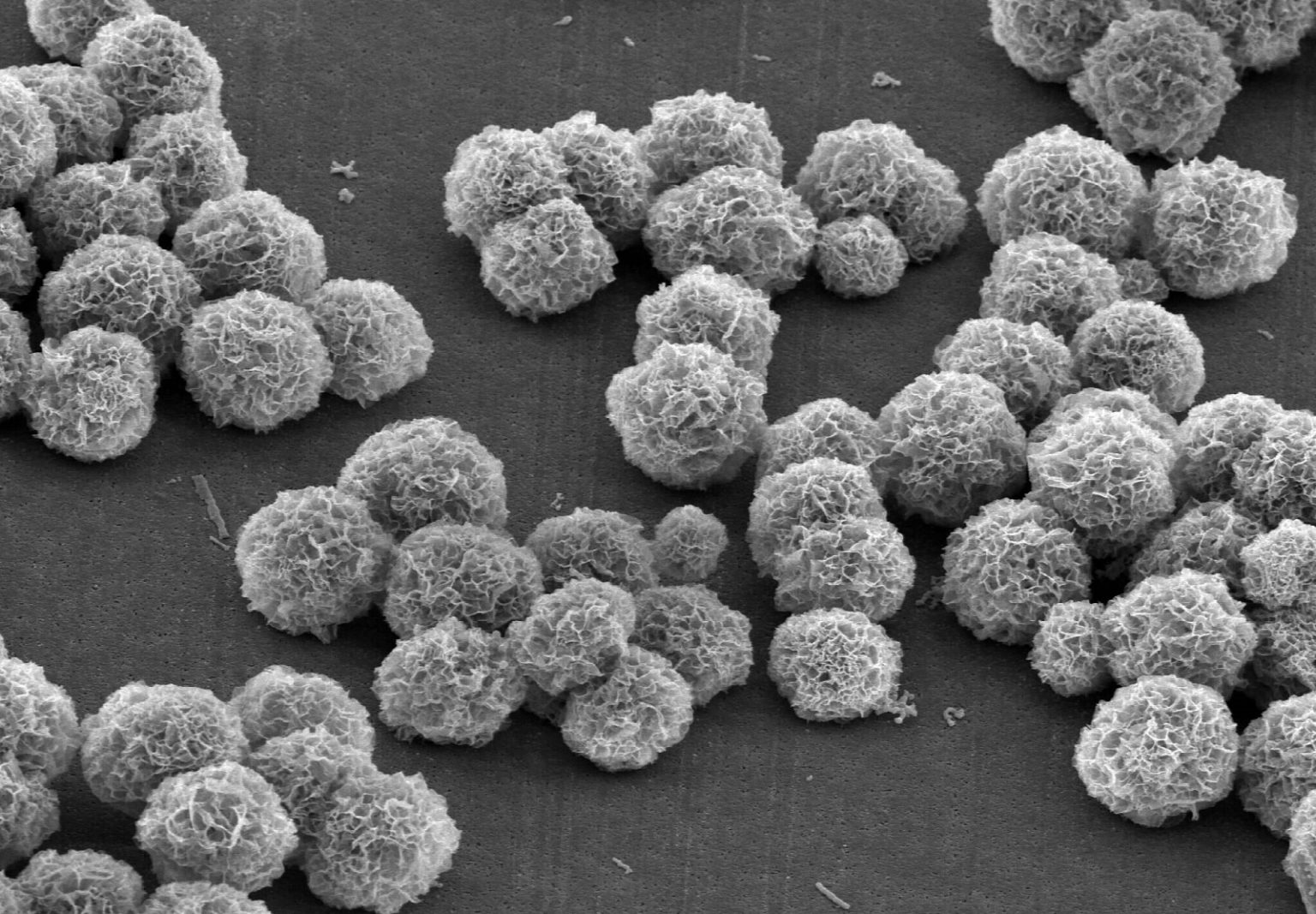 Nanoflowers as Next Generation Catalysts - Microscopy