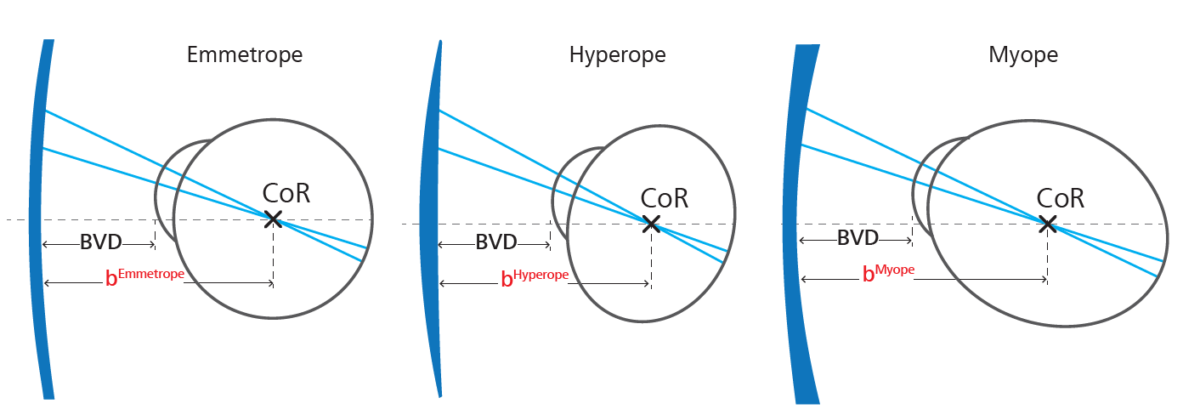 ZEISS ClearView Single Vision Lenses - ZEISS Raises the Bar